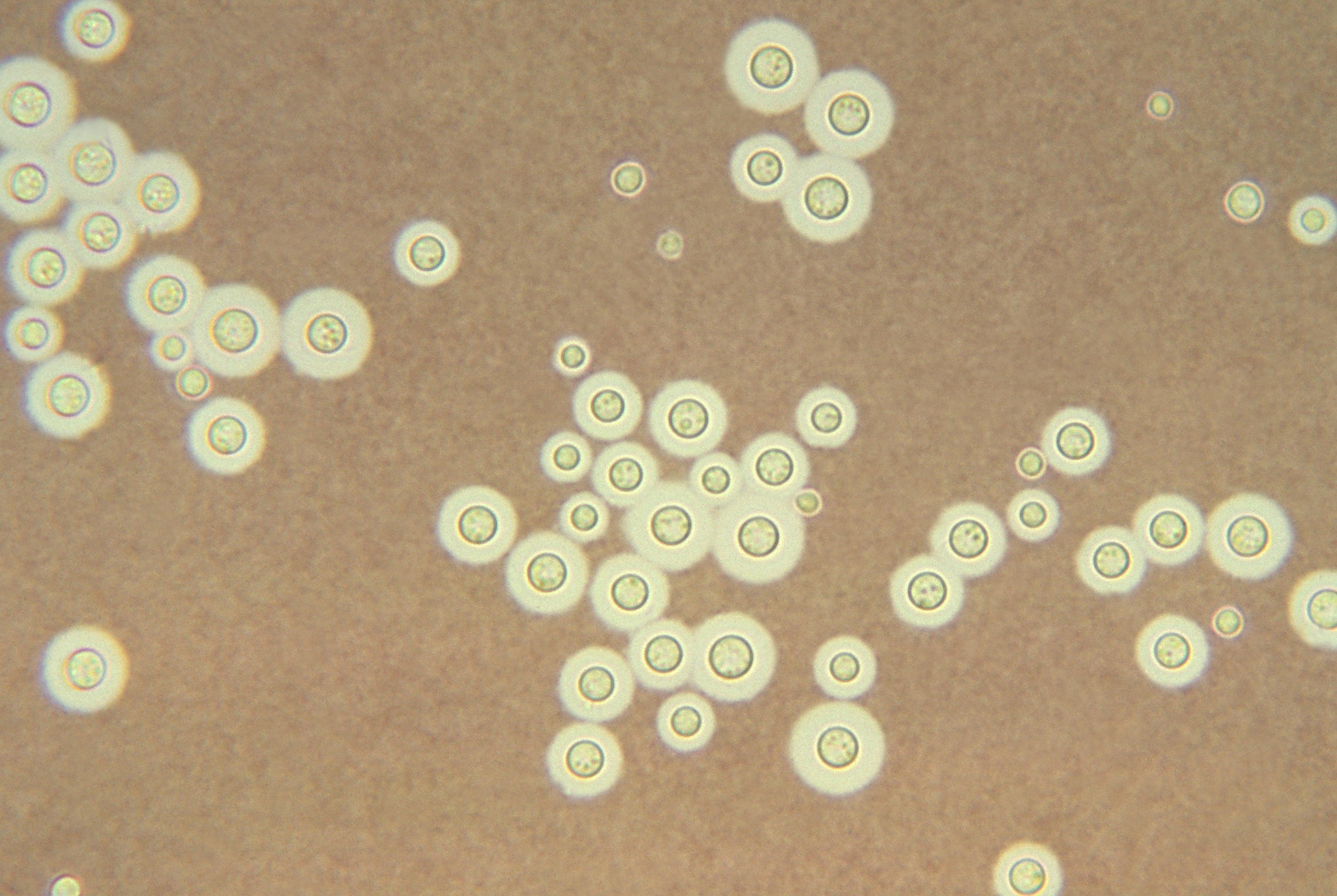 9.3: Cryptococcus neoformans - Biology LibreTexts